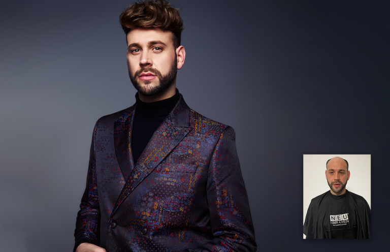 Hair Replacement Systems for Men at Voodou Salon Liverpool